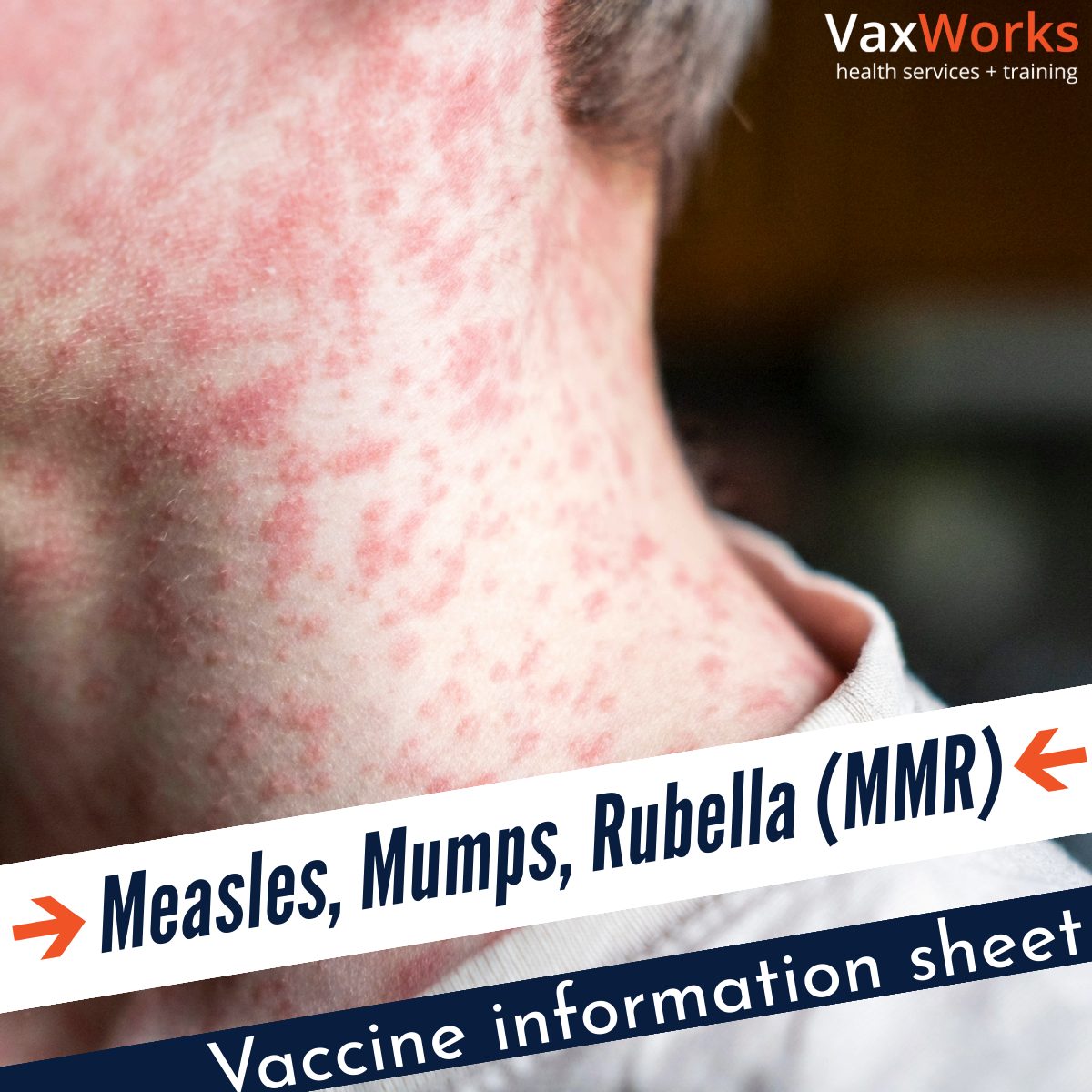 Vaccine Information Sheets – VaxWorks Health Services
